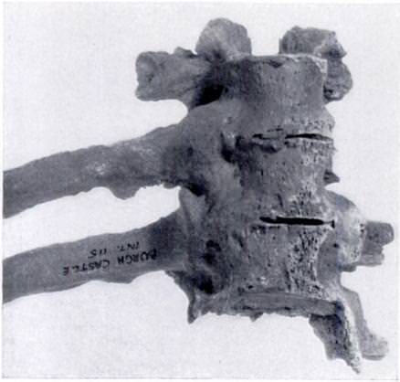 JOINT PATHOLOGY IN ANCIENT ANGLO-SAXONS - Medievalists.net